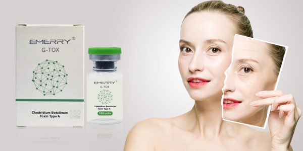 Emerry G-Tox Botulinum Toxin Type A 150 Units